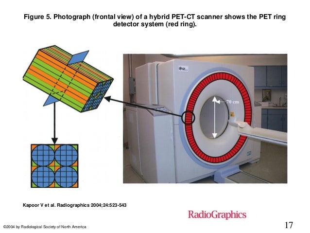 PET-CT Scan(Principles and Basics)