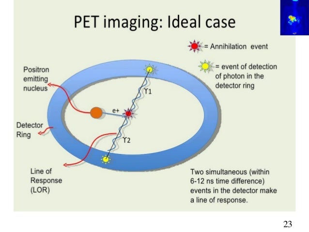 PET-CT Scan(Principles and Basics)
