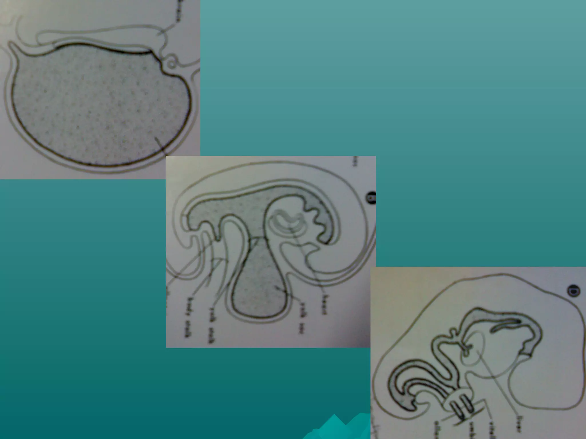 Abdominal wall defects | PPT