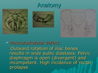 Abdominal wall defects | PPT