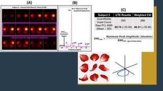 3D UTE 31P-MRSI with modified rosette k-space (PETALUTE): Comparison with conventional weighted ...