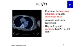 PET CT-1.pptx