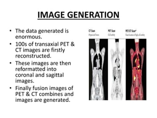 Pet ct and its benefit vs risk | PPT