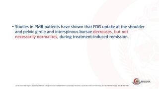 PET CT Beginners Guide part IV Covering Vasculitis and IE | PDF