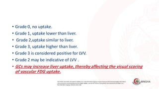 PET CT Beginners Guide part IV Covering Vasculitis and IE | PDF