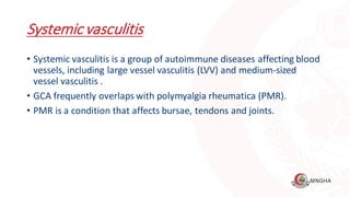 PET CT Beginners Guide part IV Covering Vasculitis and IE | PDF