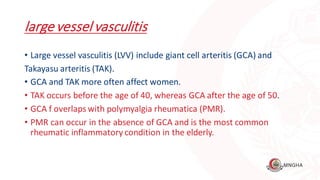 PET CT Beginners Guide part IV Covering Vasculitis and IE | PDF