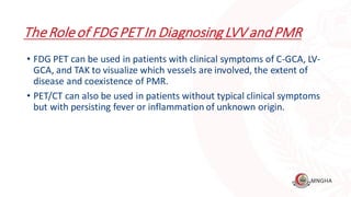 PET CT Beginners Guide part IV Covering Vasculitis and IE | PDF