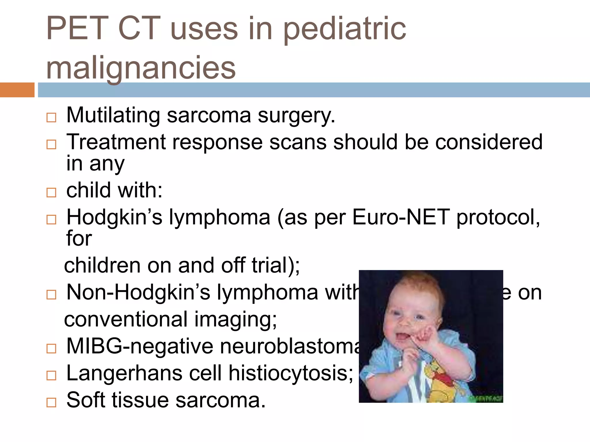 Pet ct in pediatric malignancies | PPTX