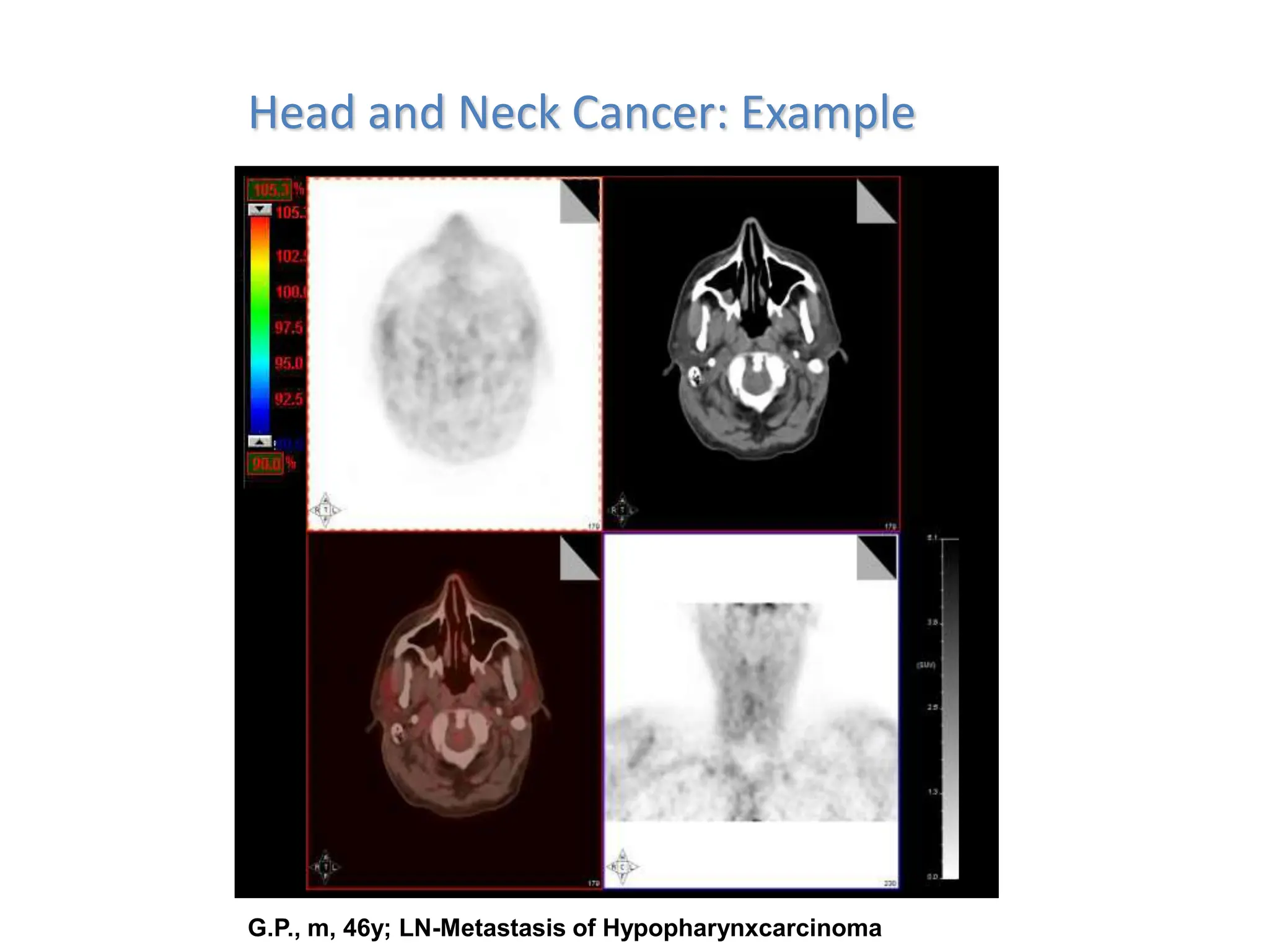 PET GUIDED TARGET CONTOURING GUIDELINES.pptx