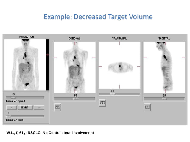 PET GUIDED TARGET CONTOURING GUIDELINES.pptx