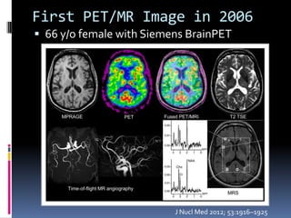 PET MR Biomedical Engineers Perspective | PPTX