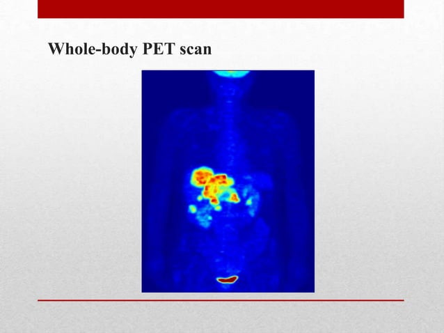 Pet positron emission tomography (pet) | PPTX