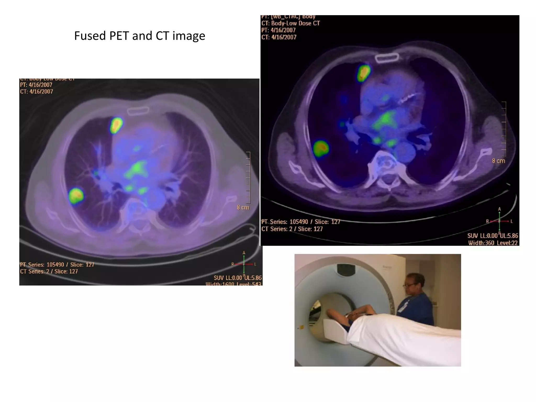 Pet presentation, positron emission tomography | PPT