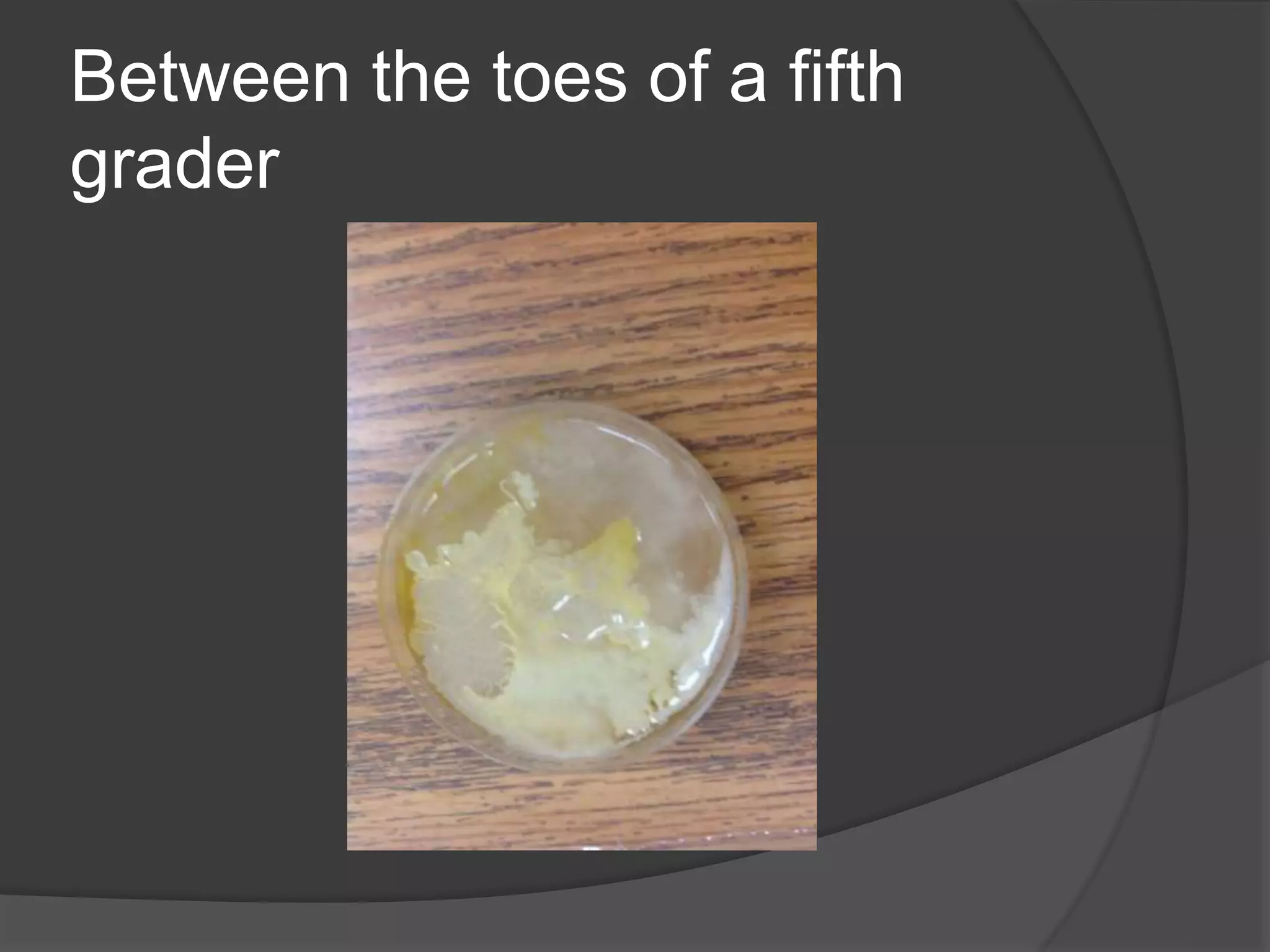 Petri dish results | PPTX | Bath and Shower | Personal Care