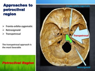 Petrosal%20approach%201012.pptx: Tailored approach | PPTX