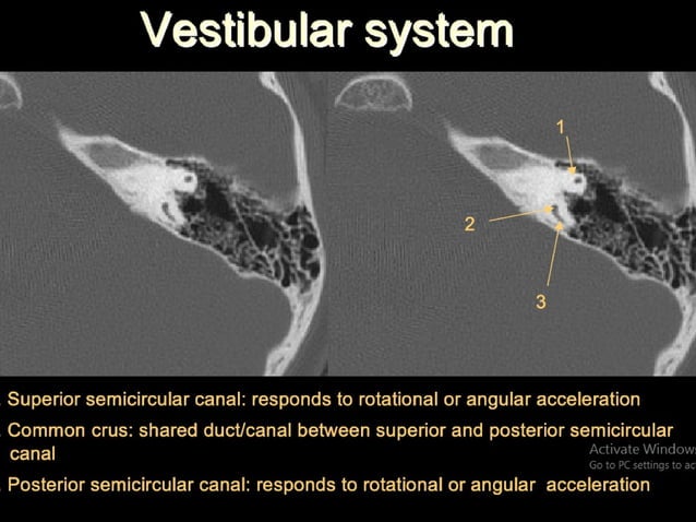 Temporal bone Radiologic anatomy.. In depth | PPT