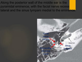 Temporal bone Radiologic anatomy.. In depth | PPT