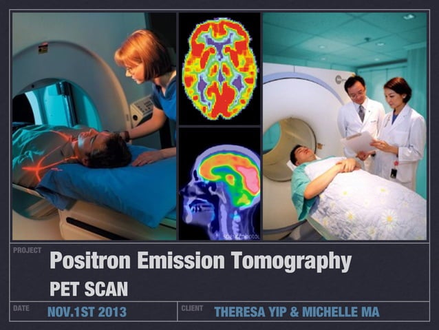 PET scan | PPT | Brain and Nervous System Disorders | Diseases and ...