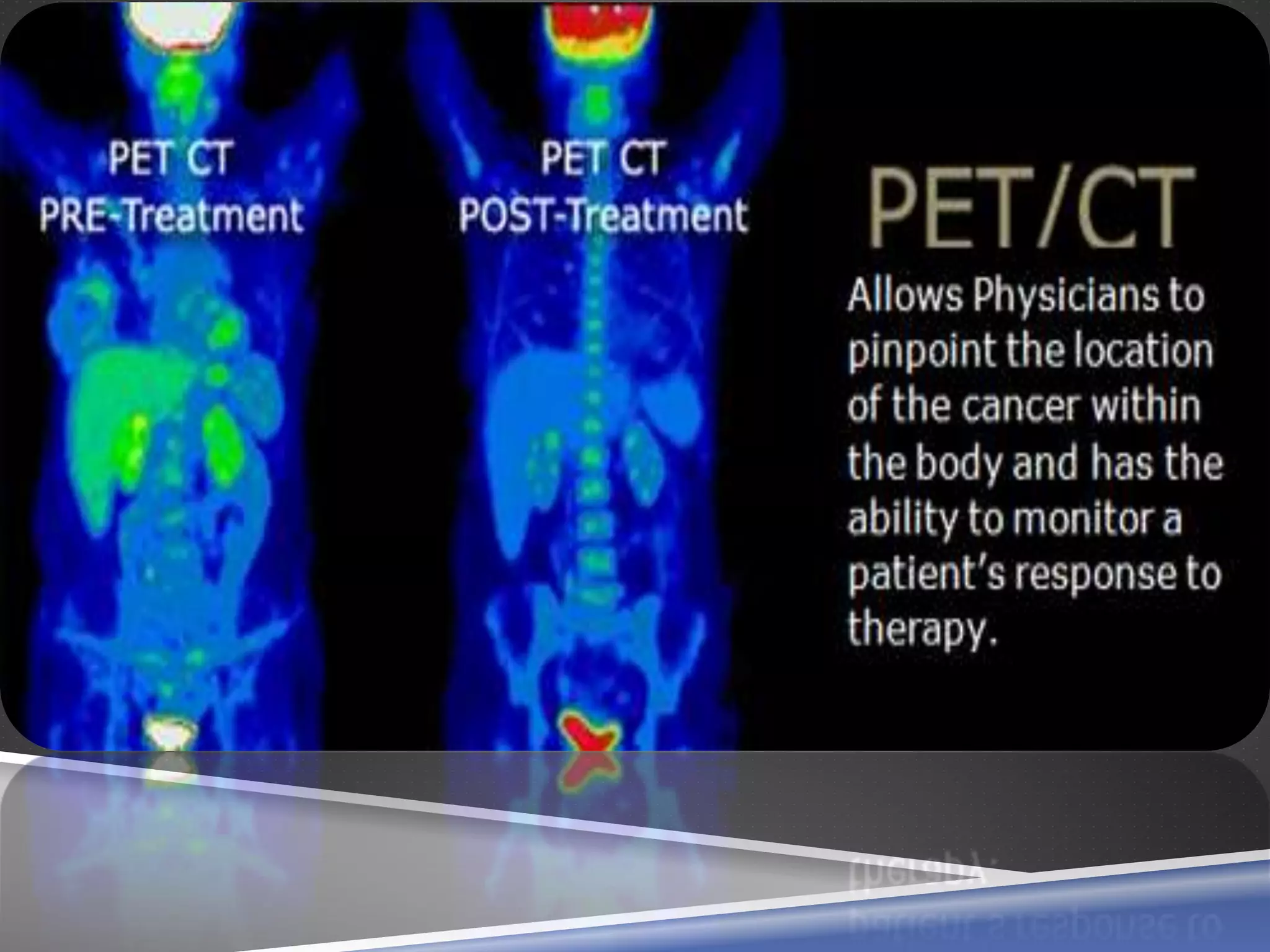 Positron Emissions Tomography (PET SCAN) | PPTX