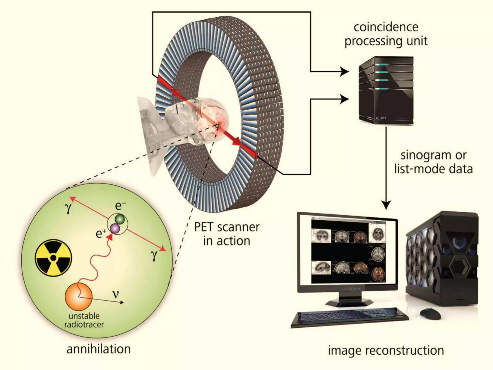 Positron Emissions Tomography (PET SCAN) | PPTX