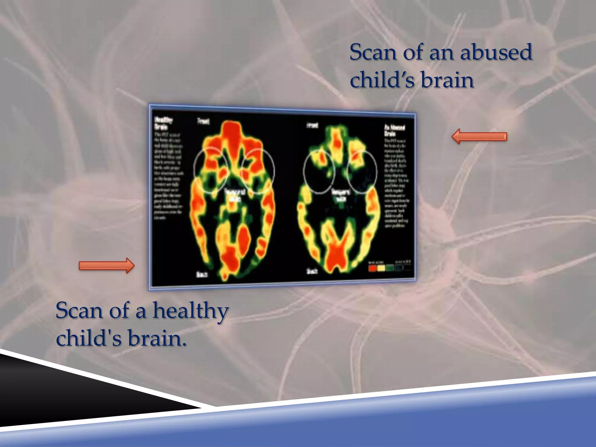 Positron Emissions Tomography (PET SCAN) | PPTX