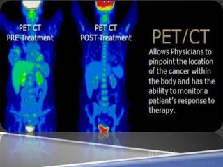 Positron Emissions Tomography (PET SCAN) | PPTX