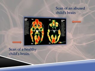 Positron Emissions Tomography (PET SCAN) | PPTX
