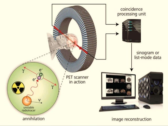 Positron Emissions Tomography (PET SCAN)