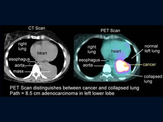 Pet scan پت اسکن | PPT