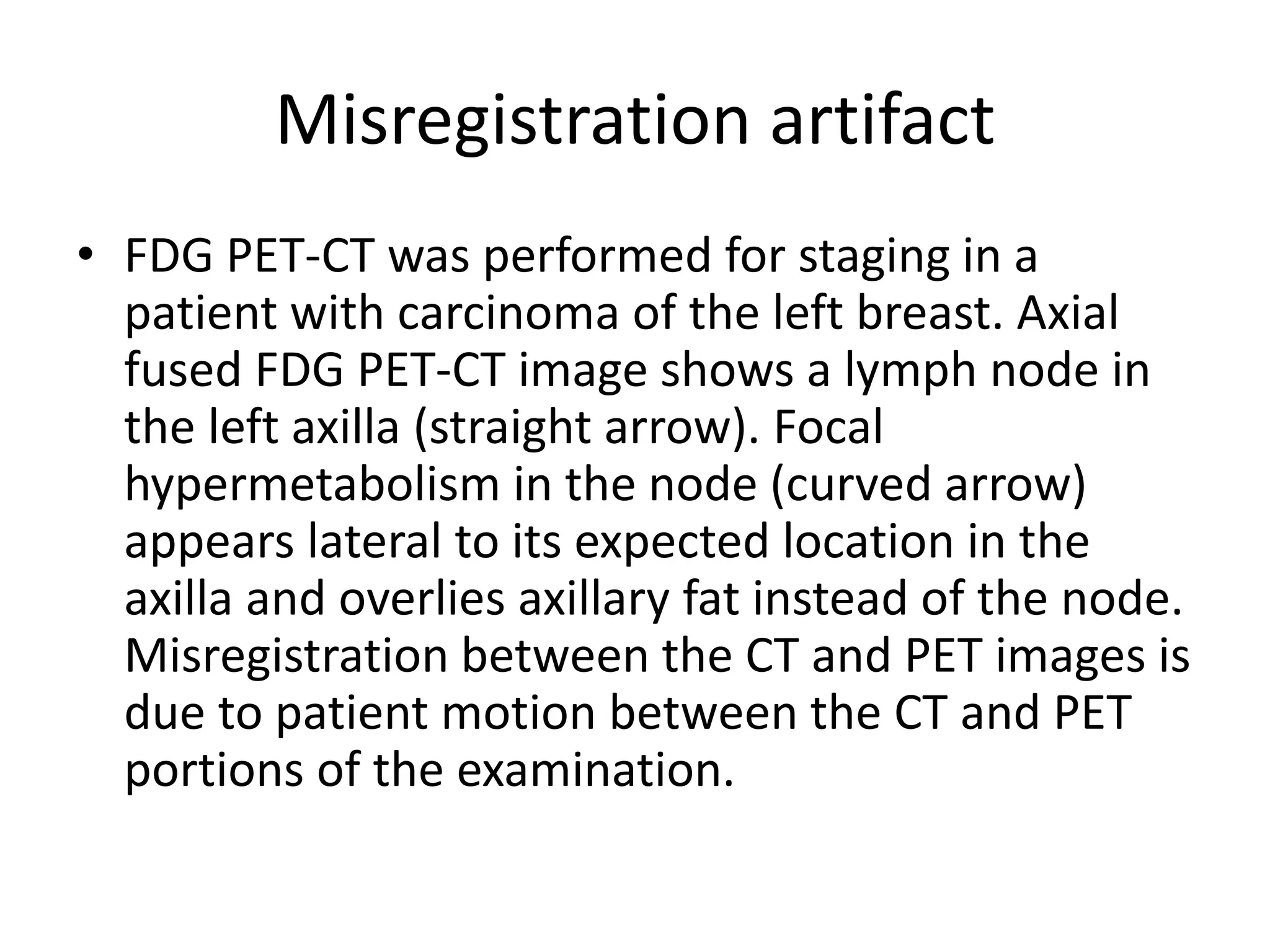 PET SCANNING.pptx