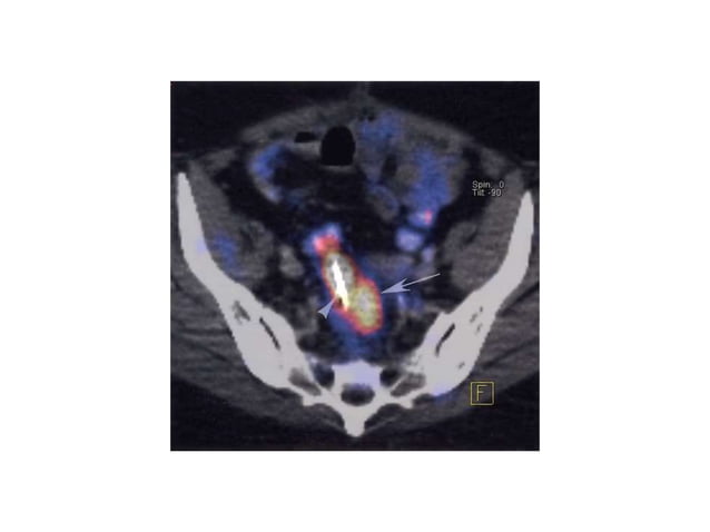 PET SCANNING.pptx