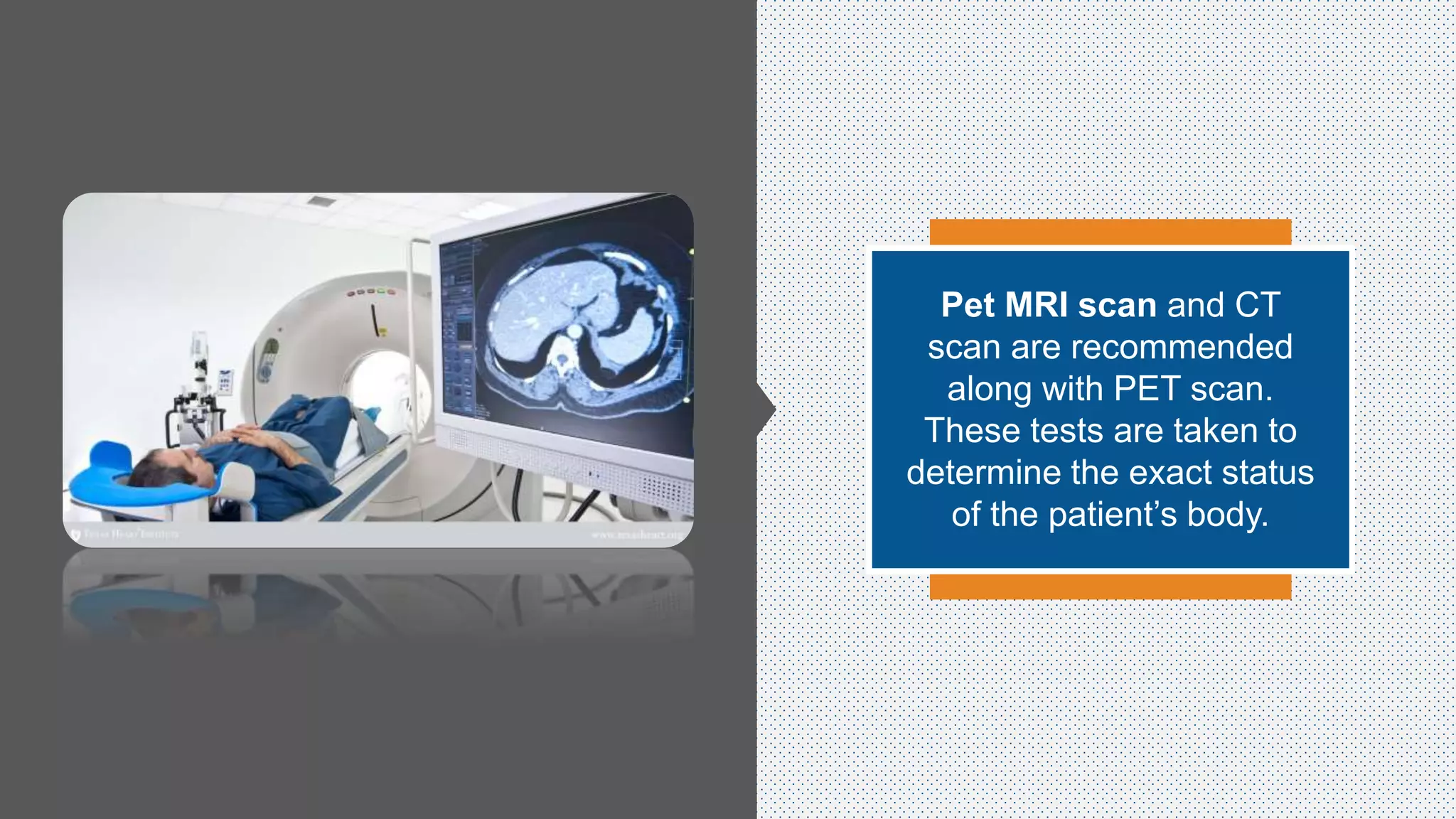 Pet scan shows cancer | PPT | Free Download