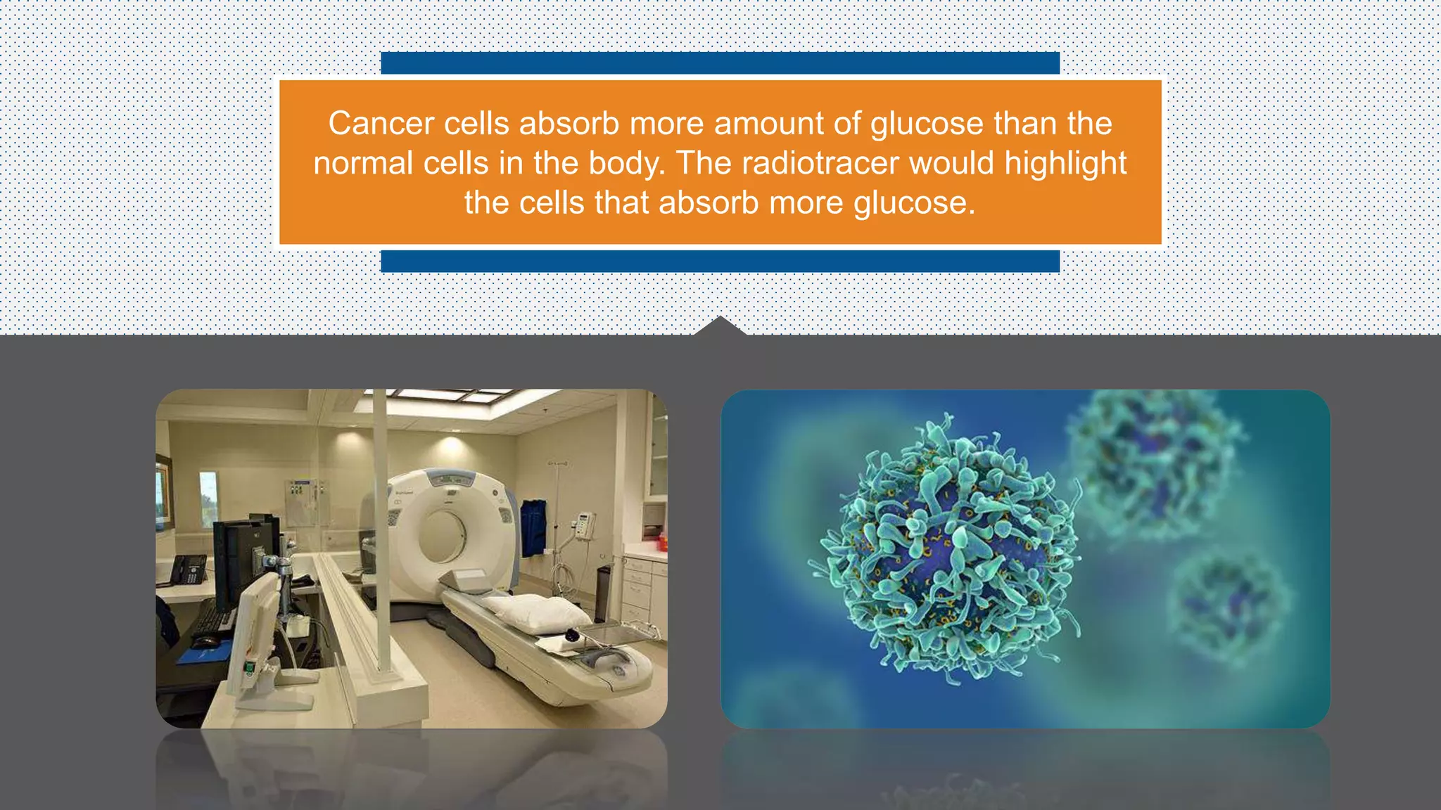 Pet scan shows cancer | PPT