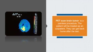 Pet scan shows cancer | PPT