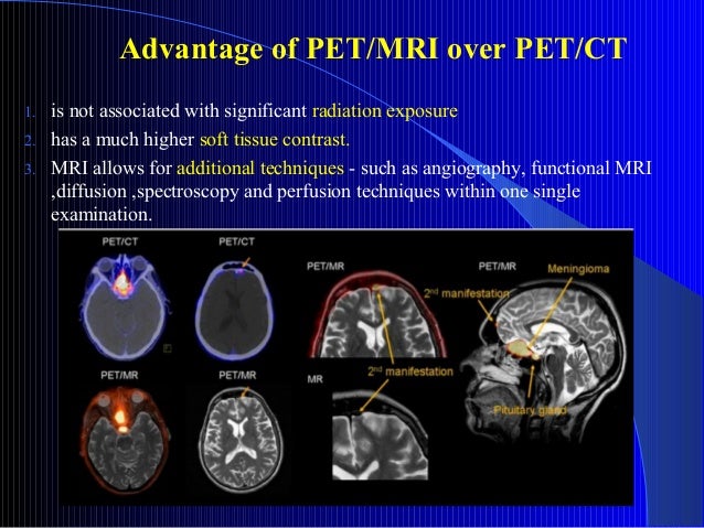Principles and application of PET CT & PET MR Principles and application of PET CT & PET MR