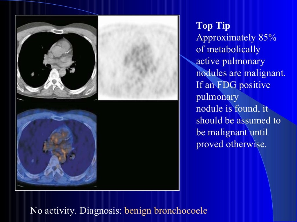 Principles and application of PET CT & PET MR Principles and application of PET CT & PET MR