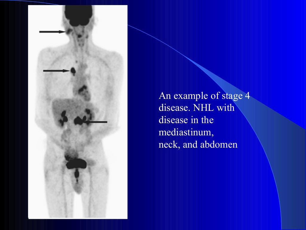Principles and application of PET CT & PET MR Principles and application of PET CT & PET MR