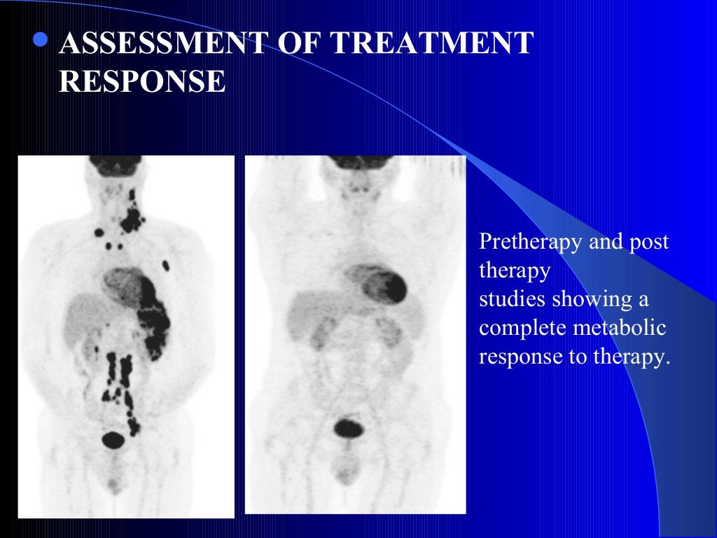 Principles and application of PET CT & PET MR Principles and application of PET CT & PET MR