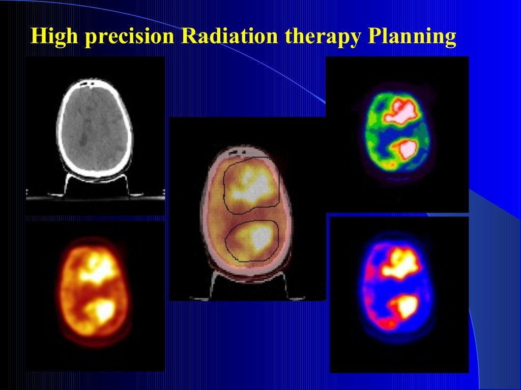 Principles and application of PET CT & PET MR Principles and application of PET CT & PET MR