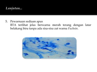 Pewarnaan bakteri | PPTX