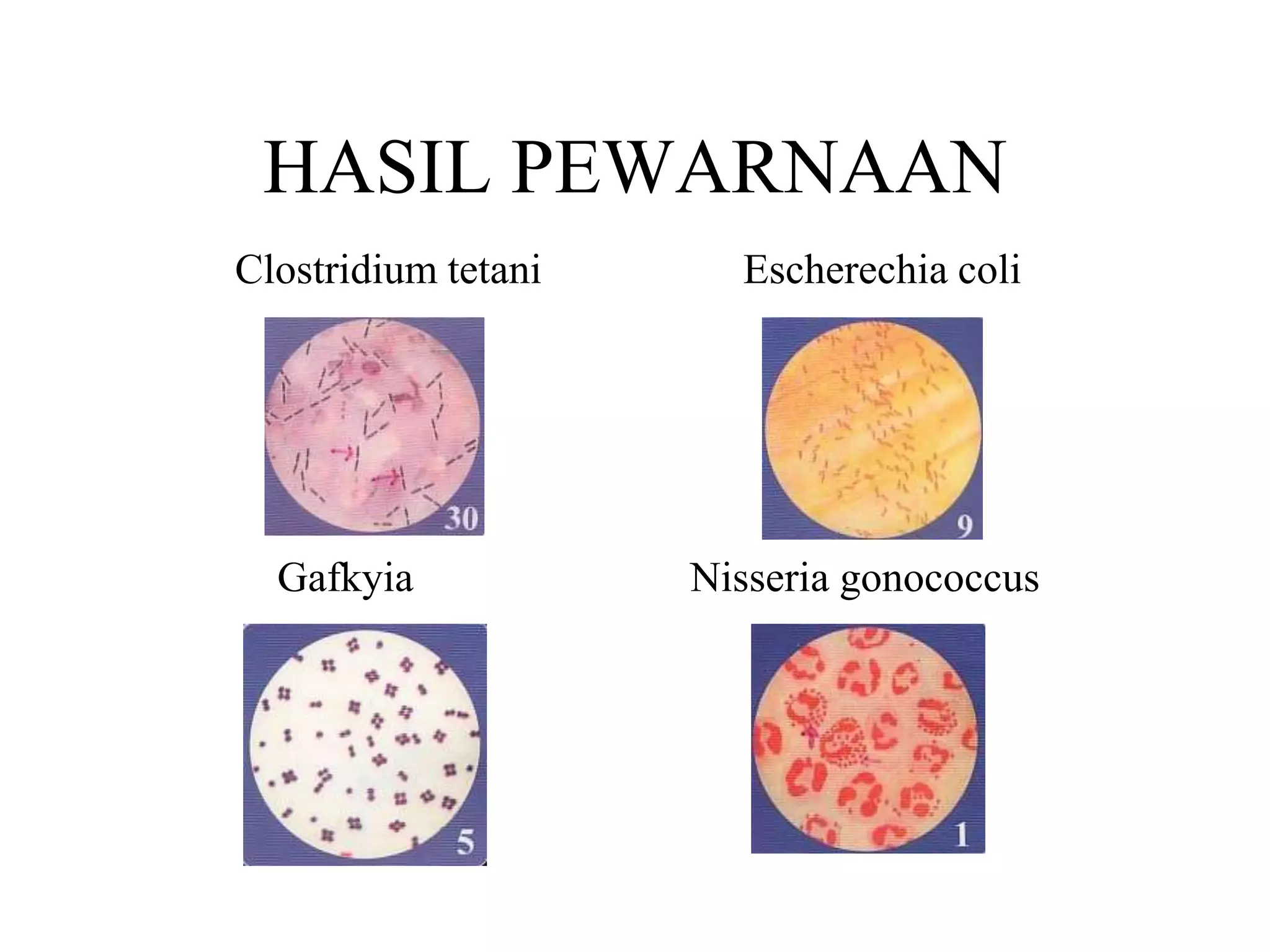 Pewarnaan gram + bakteriologi urin | PPTX