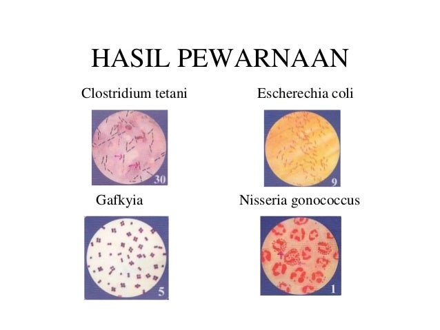 Pewarnaan gram + bakteriologi urin