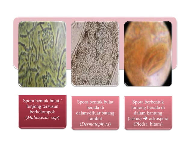 Pewarnaan parasit dan jamur | PPTX