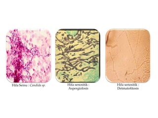 Pewarnaan parasit dan jamur | PPTX