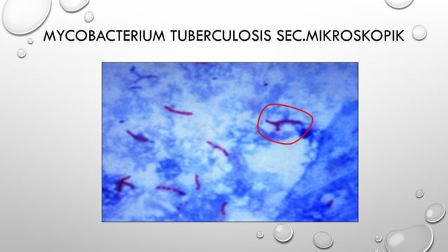 PEWARNAAN ZN PADA UJI MIKROBIOLOGI .pptx