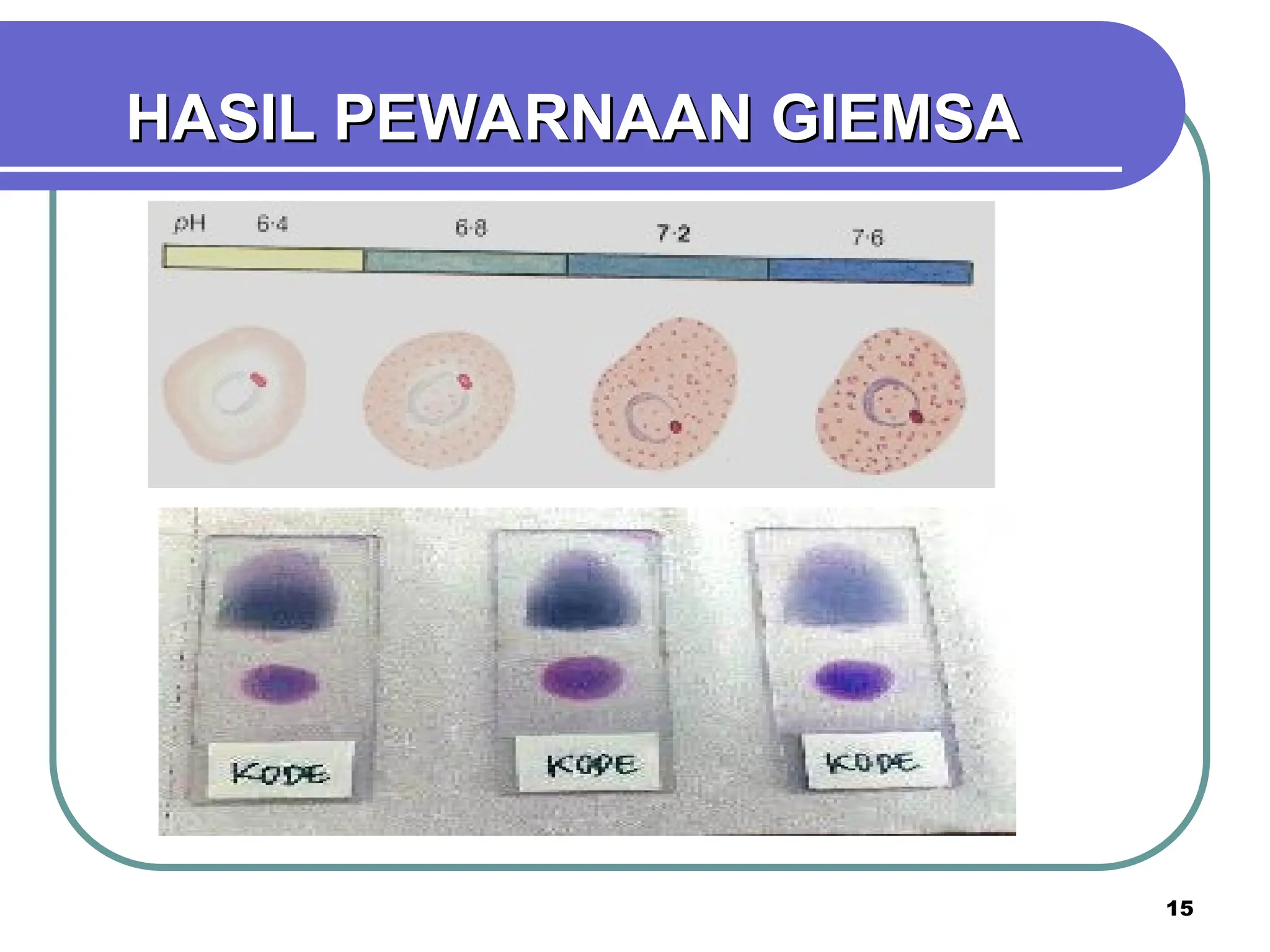 Bagaimana Pewranaan Sediaan Darah Malaria | PPT