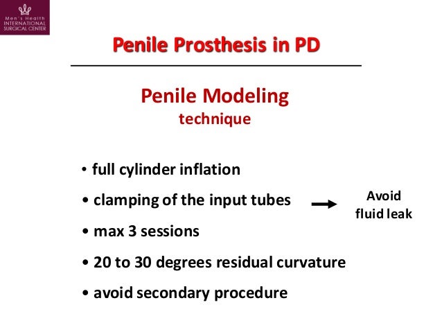Peyronie's Disease: a tailored surgical procedure for every patient