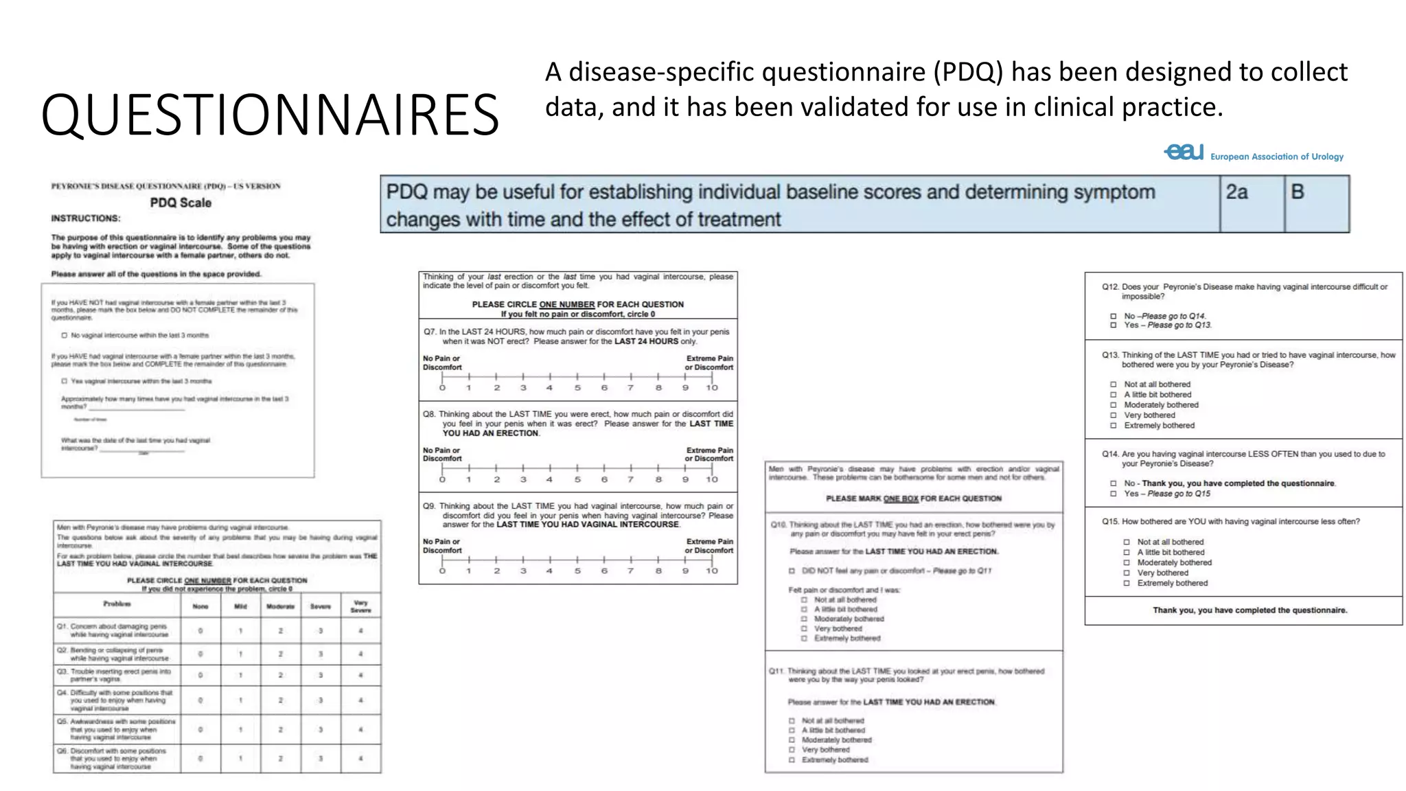 Peyronies disease: diagnostic | PPTX