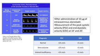 Peyronies disease: diagnostic | PPTX